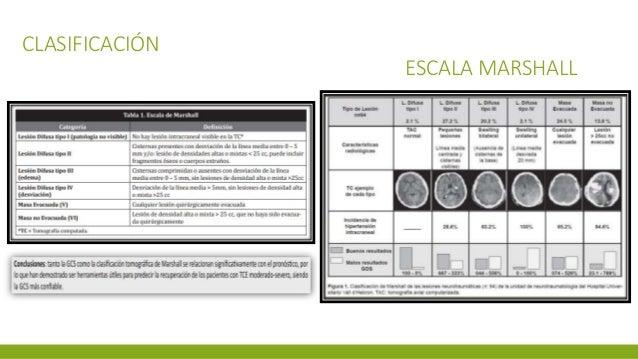 Traumatismo intracraneal