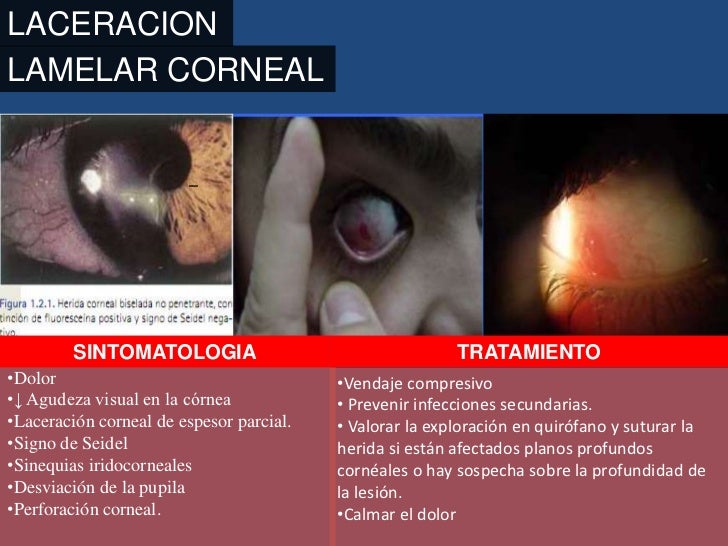 Traumatismo ocular