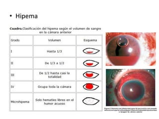 Traumatismo ocular | PPTX