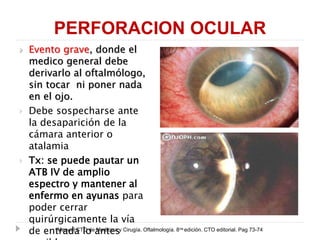 Traumatismo ocular | PPTX