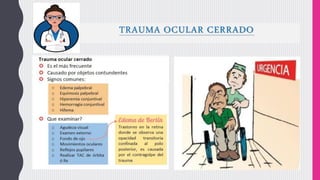 TRAUMATISMO OCULAR.pptx