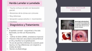 TRAUMATISMO OCULAR.pptx