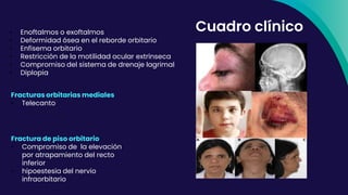 Traumatismo ocuuuuuuuuuuuuuuuuiular.pptx