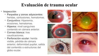 Traumatismo ocular del segmento anterior.pptx