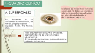 TRAUMATISMO OCULARTRAUMATISMO OCULAR.pptx