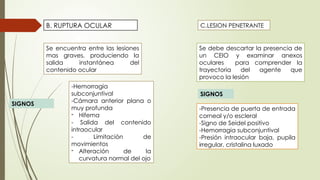 TRAUMATISMO OCULARTRAUMATISMO OCULAR.pptx