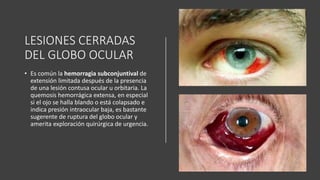 TRAUMATISMO OFTALMICO.pptx
