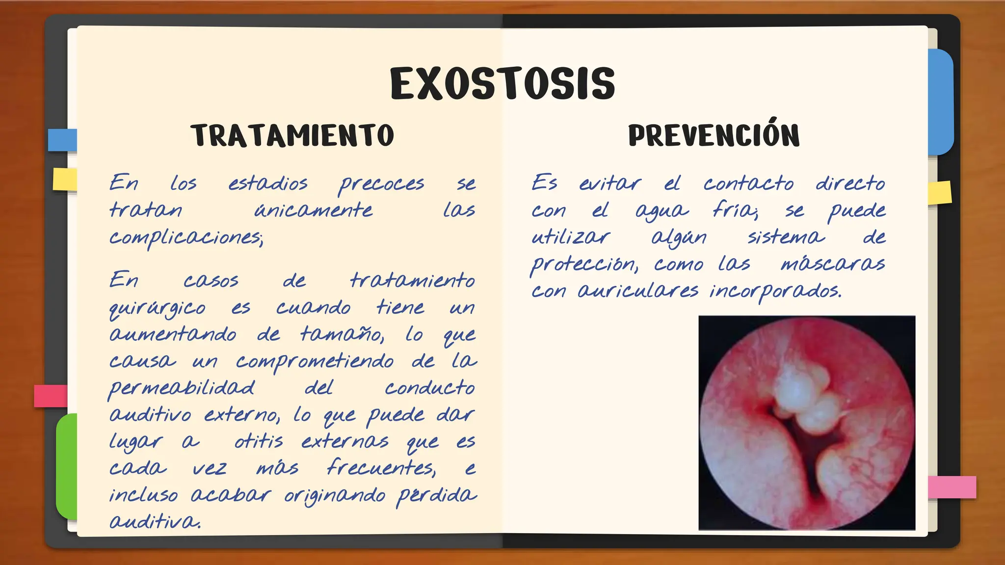 Traumatismo oído medio y externo.pptx