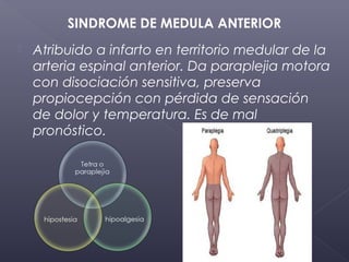 Traumatismo raquimedular vrsion 03 | PPT