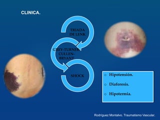 TRAUMATISMO RETROPERITONEAL EN TRAUMAS 01.pptx