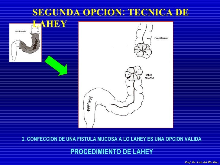 TRAUMATISMOS DEL COLON RECTO Y ANO - Prof. Dr. Luis del Rio Diez