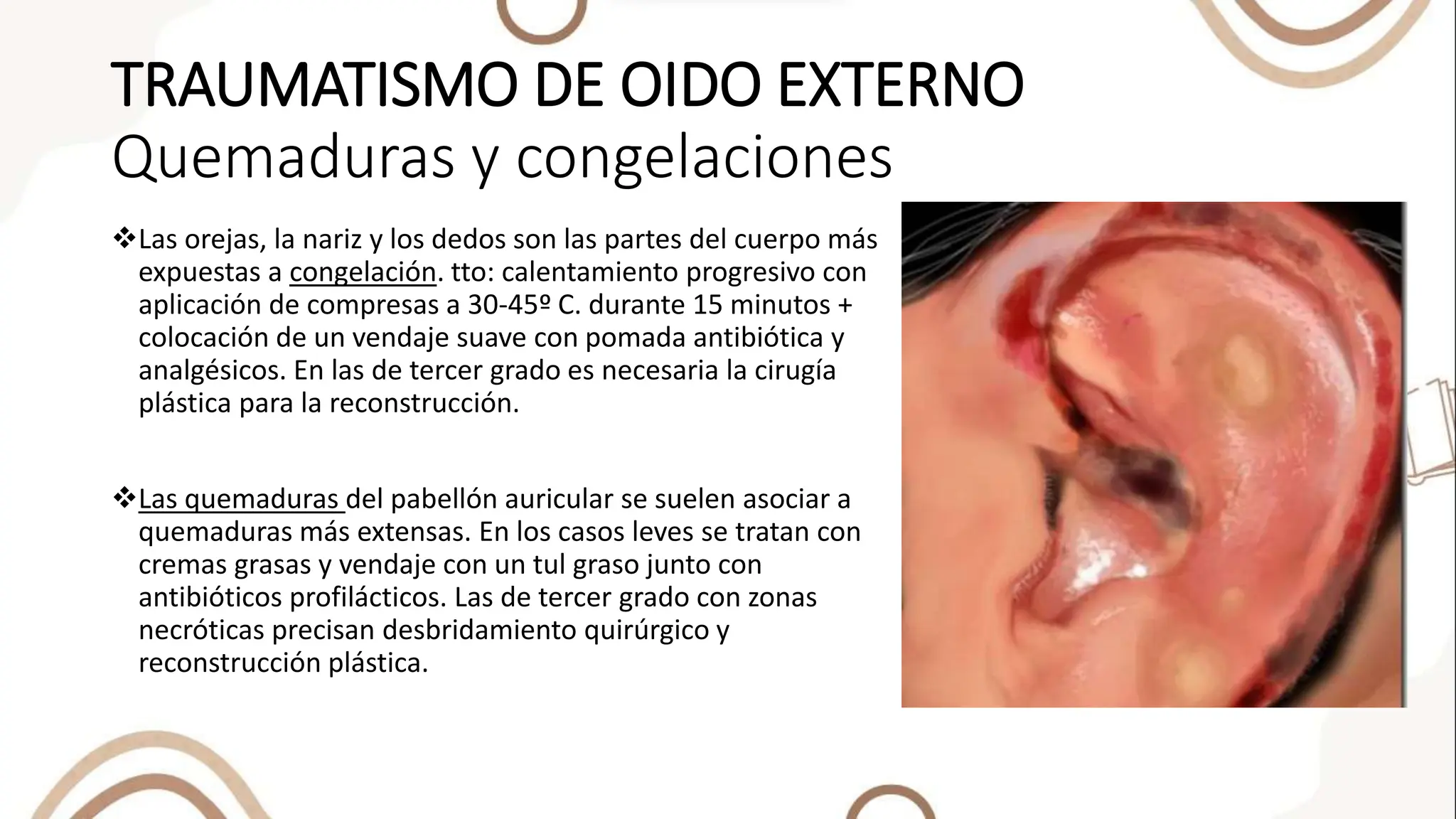 TRAUMATISMOS DEL OIDO. Residencia de otorrinolaringologia. | PPTX