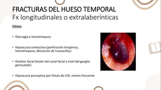 TRAUMATISMOS DEL OIDO. Residencia de otorrinolaringologia. | PPTX