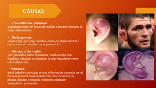 Traumatismos del pabellon auricular.pptx