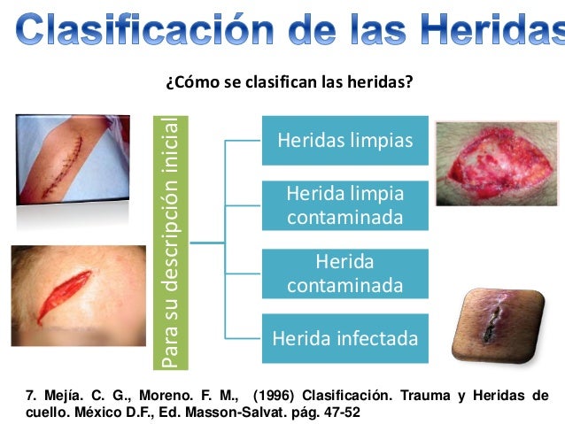 Traumatismos, heridas y contusiones de cuello.