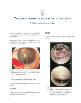 Traumatismos oculares | PDF