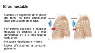 Traumatismo Toracico | PDF | Death, Injury, or Military Conflict ...