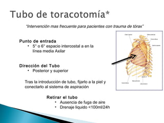 Traumatismo toracoabdominal | PPT
