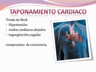 Traumatismo Toracico y sus Complicaciones | PPT