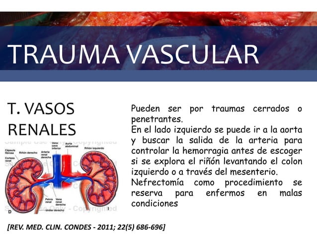 TRAUMA VASCULAR | PPTX