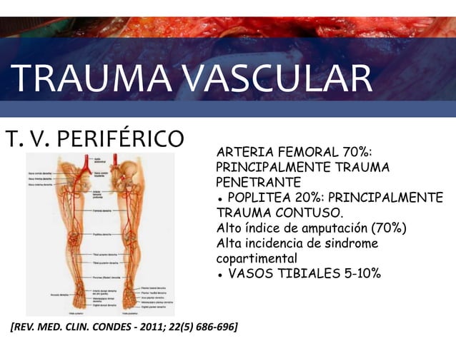 TRAUMA VASCULAR | PPTX