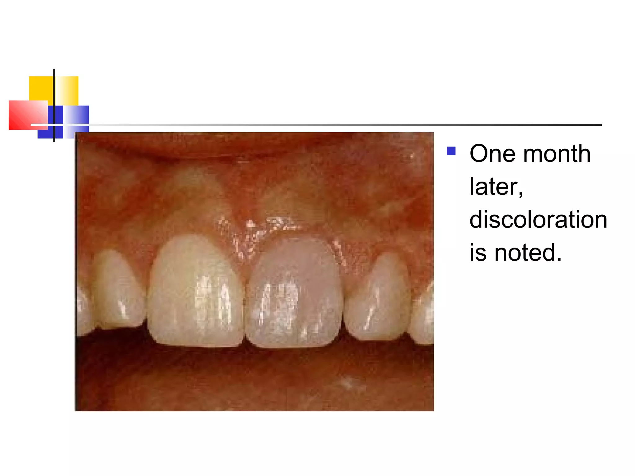 Traumatized Teeth | PPT