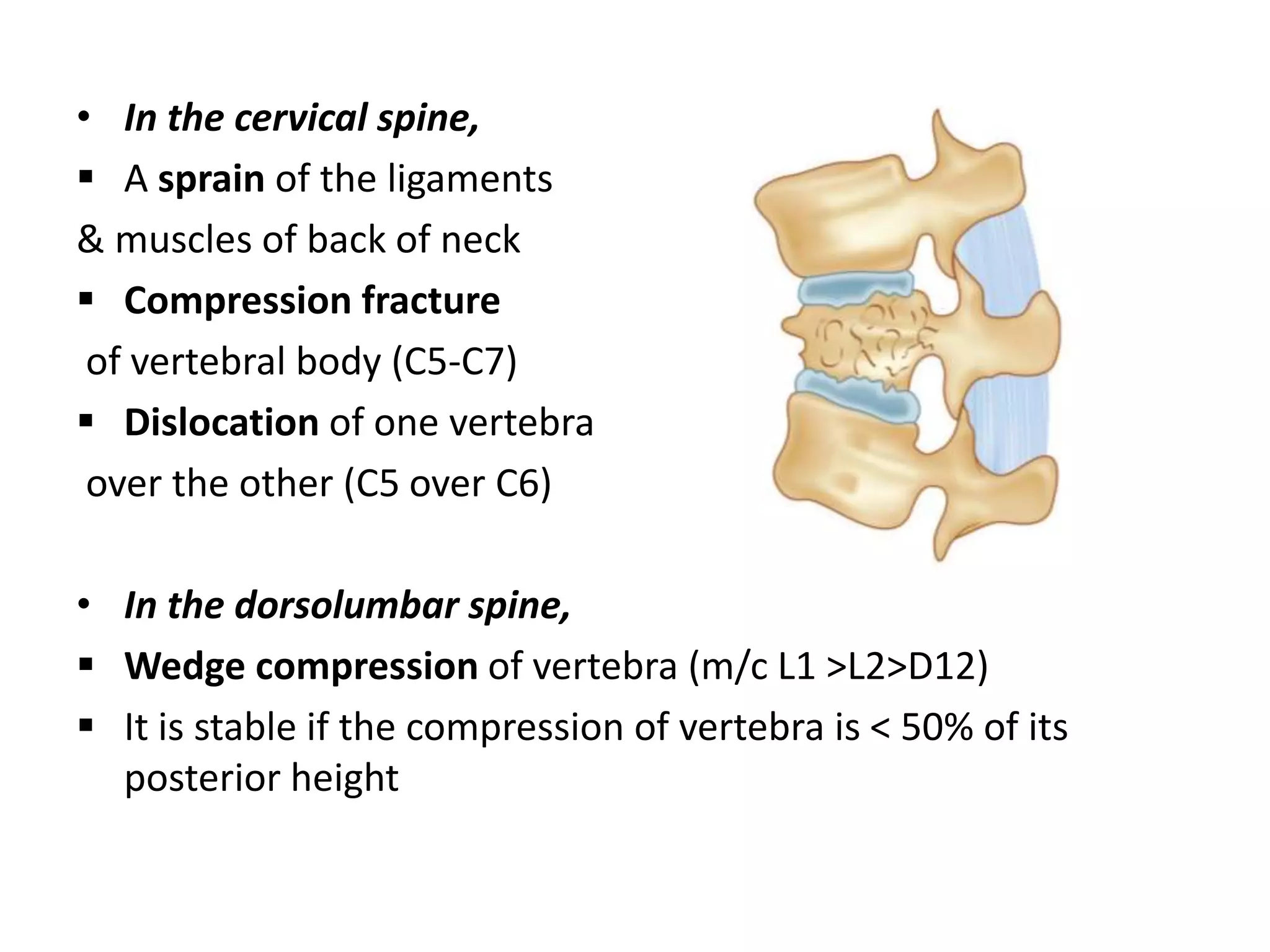 Trauma to cervical spine & thoracolumbar spine - Anatomy, Mechanism ...
