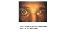 Trauma to eye REVISION NOTES | PPTX
