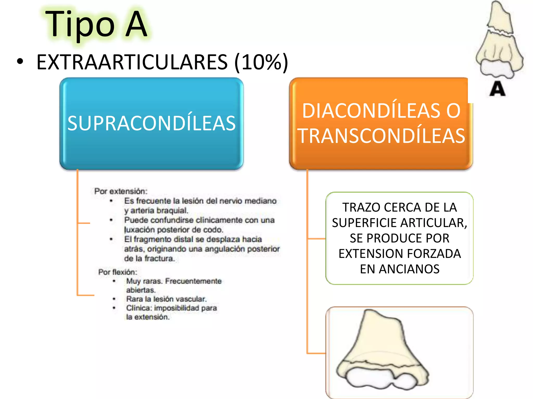 FRACTURA DE HUMERO DISTAL | PPTX