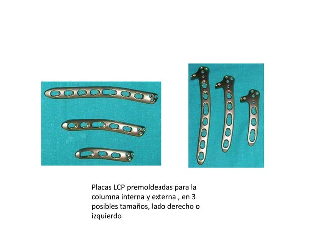 FRACTURA DE HUMERO DISTAL | PPTX