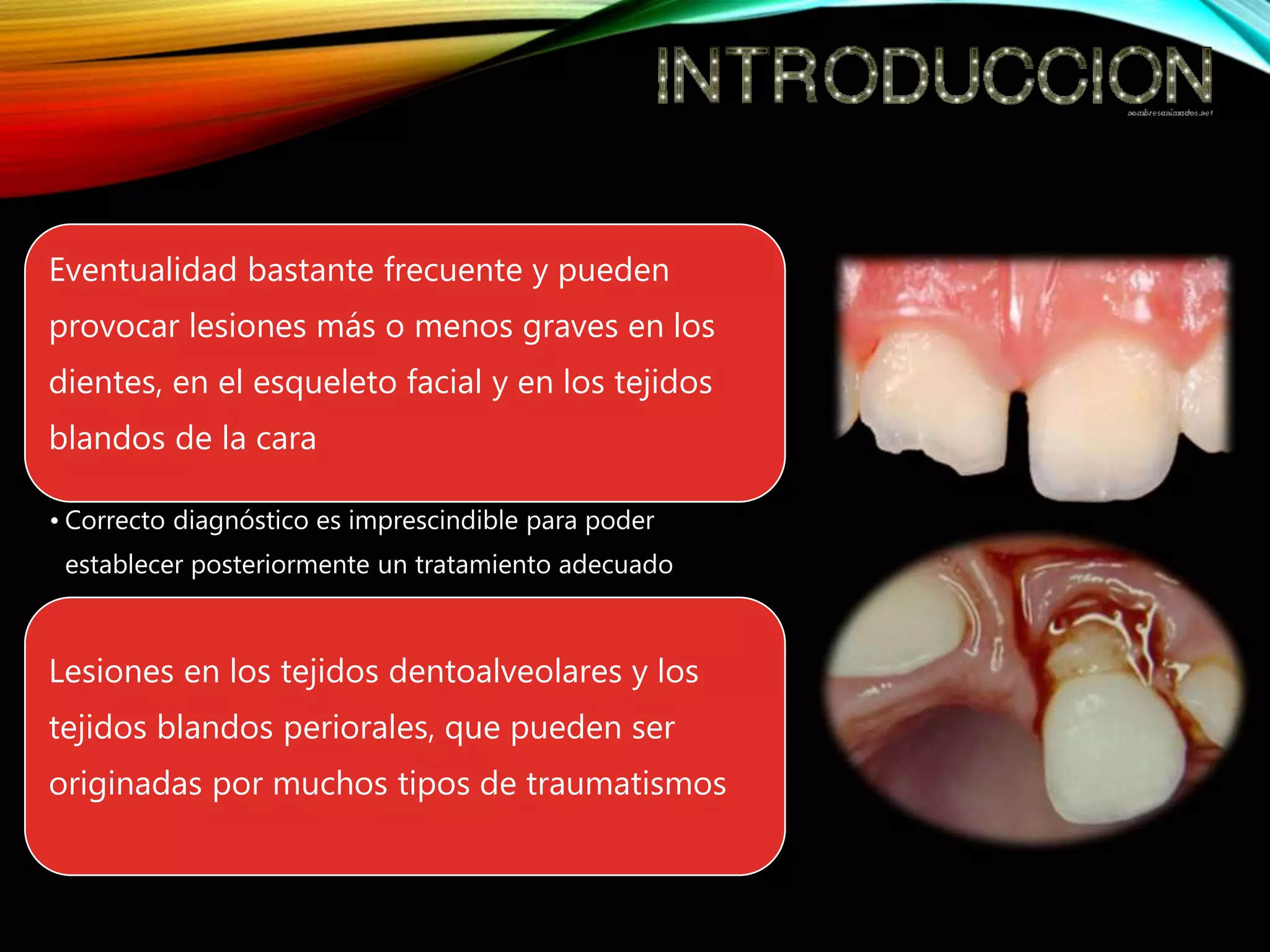Traumatología dentoalveolar | PPTX