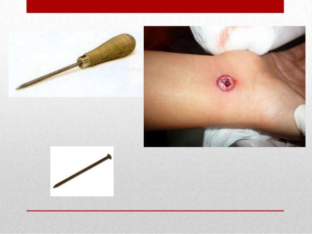 Traumatología forense