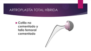 Anatomia general del area de traumatologia | PDF