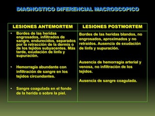 Traumatologia Forense Pptx