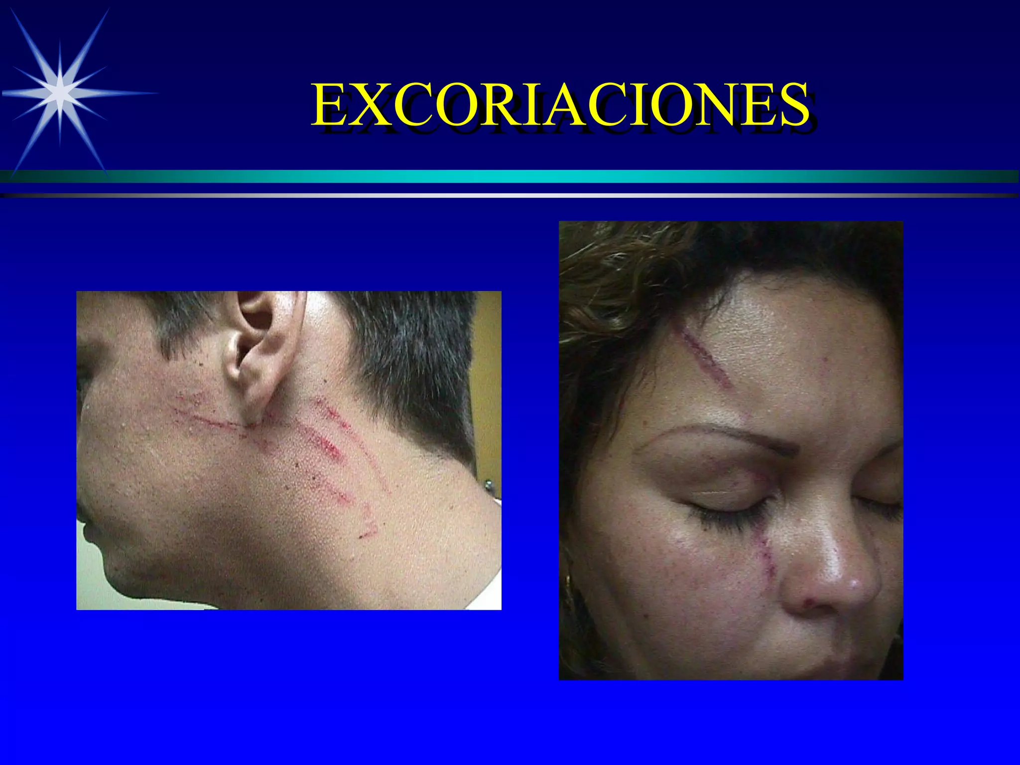 Traumatologia forense