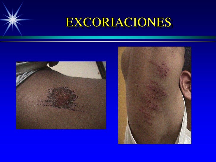 Traumatologia forense