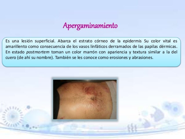 TRAUMATOLOGIA FORENSE MEDICINA LEGAL