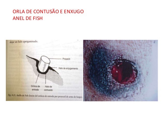 Traumatologia forense parte 1 Direito UFPA