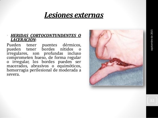 Traumatologia forense rocio madrid final