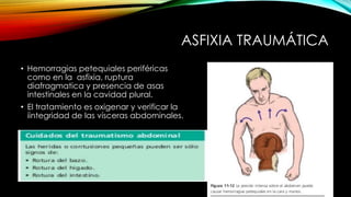 Traumatologia tronco | PPTX