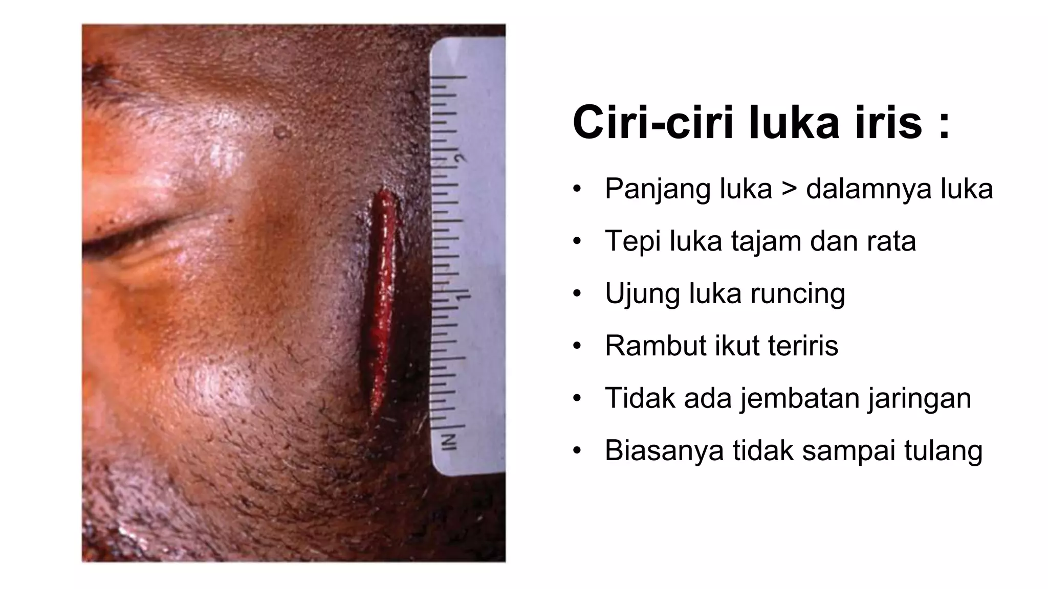 TRAUMA.pptx