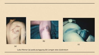 TRAUMA.pptx