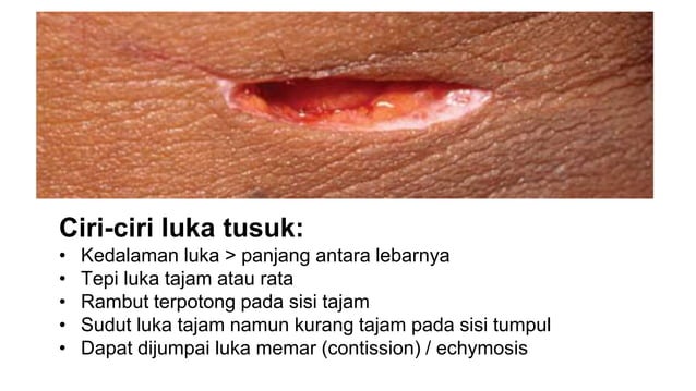 TRAUMA.pptx