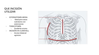 Comprehensive Management of Thoracic Trauma: Diagnosis and Surgical ...