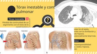 trauma torácico definitivo en emergencia | PPTX