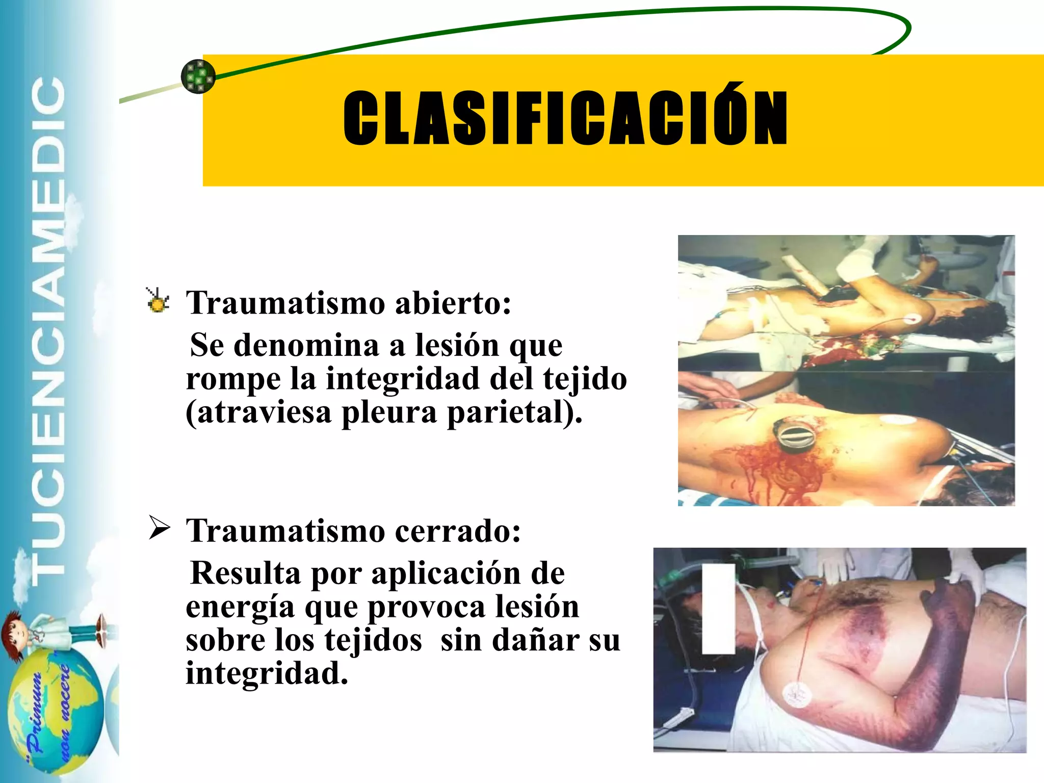 Trauma Toracico FMH UNPRG TUCIENCIAMEDIC | PPT