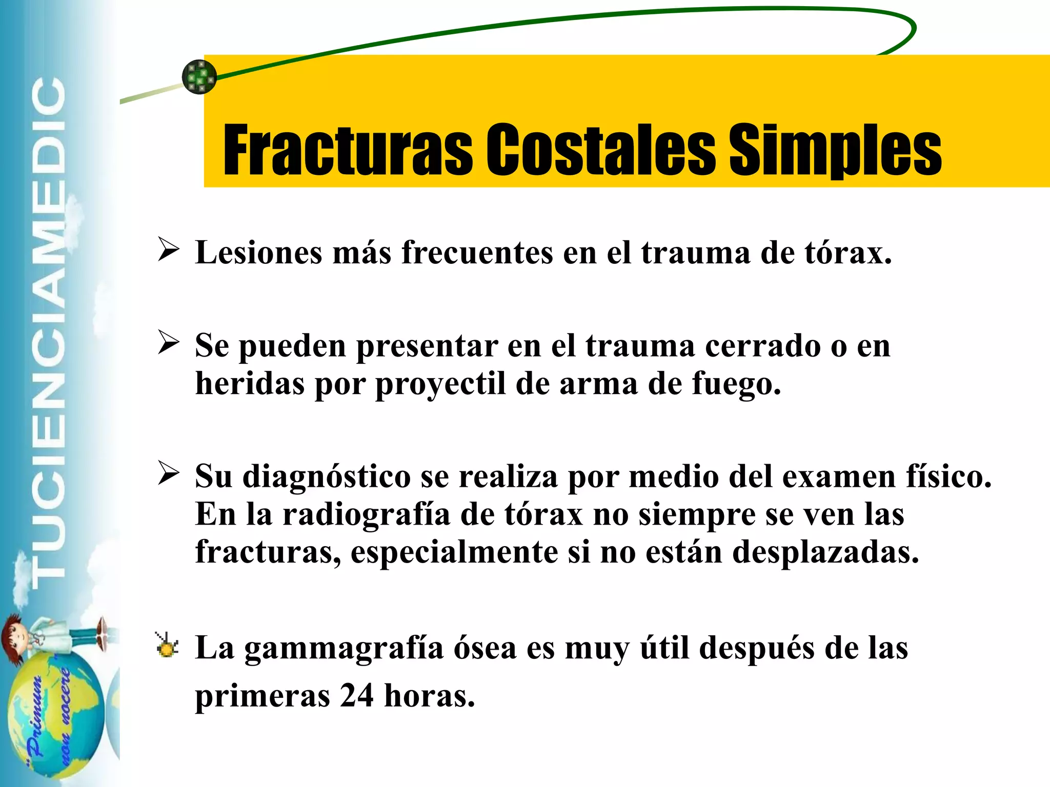 Trauma Toracico FMH UNPRG TUCIENCIAMEDIC | PPT