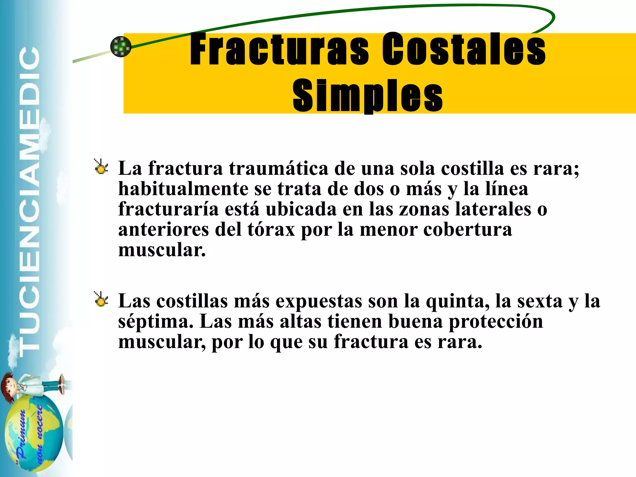 Trauma Toracico FMH UNPRG TUCIENCIAMEDIC | PPT