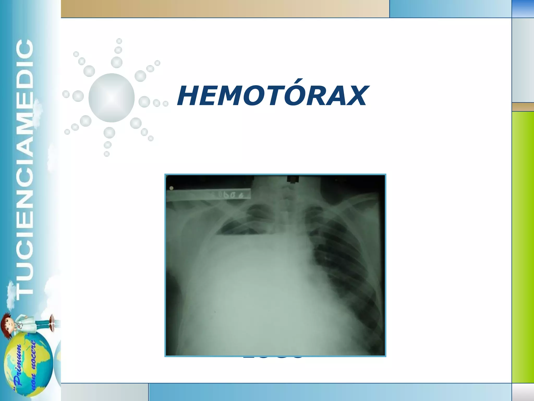 Trauma Toracico FMH UNPRG TUCIENCIAMEDIC | PPT