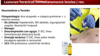 TRAUMA TORAX manejo y complicaciones para | PPTX